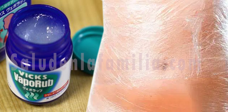 Crema de Vicks VapoRub para eliminar grasas y estrías ...